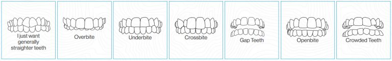 Invisalign Sydney | Clear Aligners | Sydney CBD Dentistry